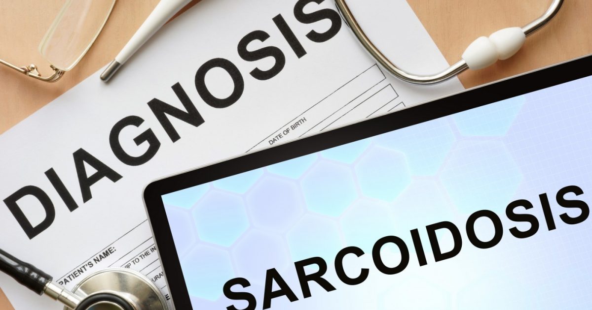 Better Diagnostic Test for Sarcoidosis-associated Uveitis Identified in ...