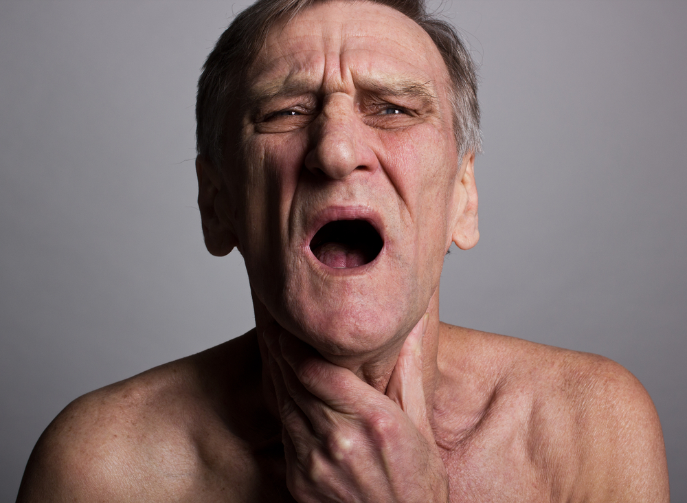 Case Report Associates Swallowing Problems With Sarcoidosis